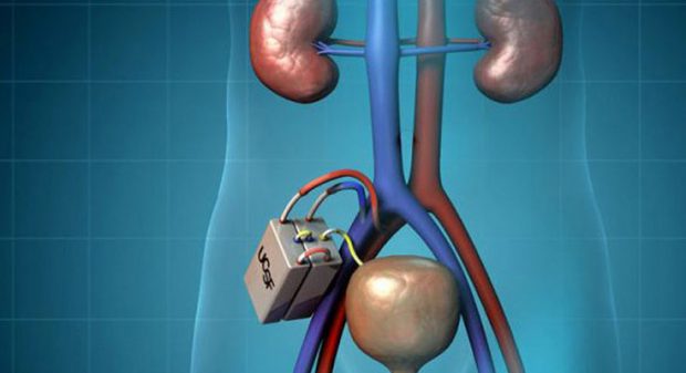 Conheça o “rim biônico” que pode revolucionar a vida de quem depende de ...